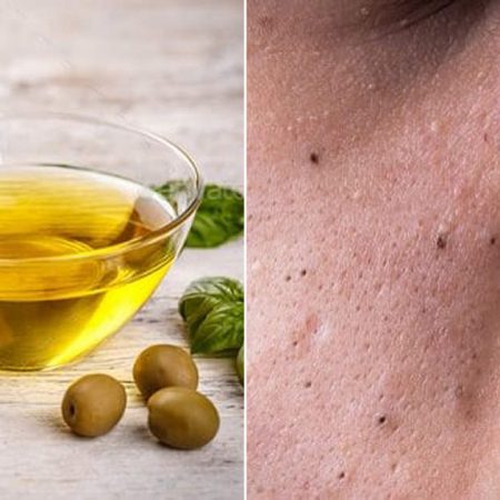 17 Essential Oils to Get Rid of Flies Naturally ⋆ Bright Stuffs